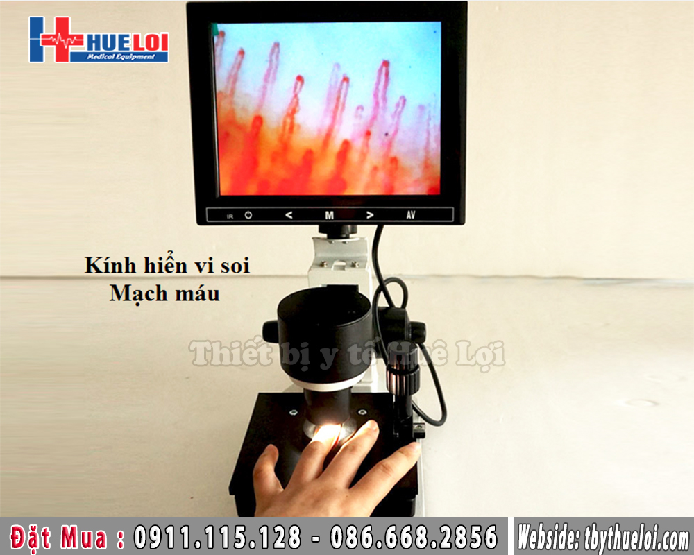 Kính Hiển Vi Soi Mạch Máu Phát Hiện Bất Thường